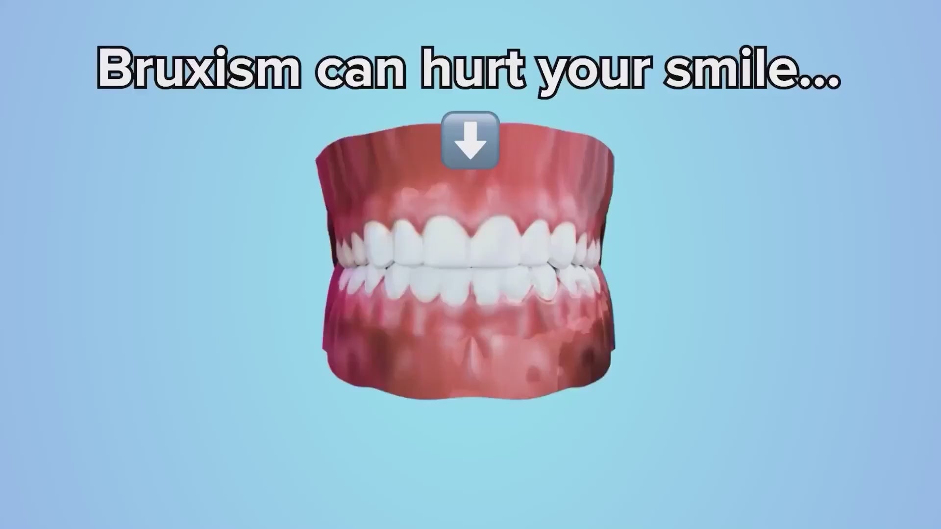Custom Night Guards for Grinding | Dentist-Quality Comfort for Teeth – Remi